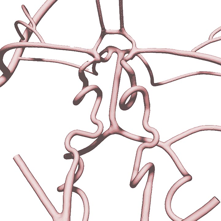 Circle of Willis Model with Challenge ICA – United Biologics